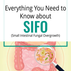 Everything You Need to Know about SIFO