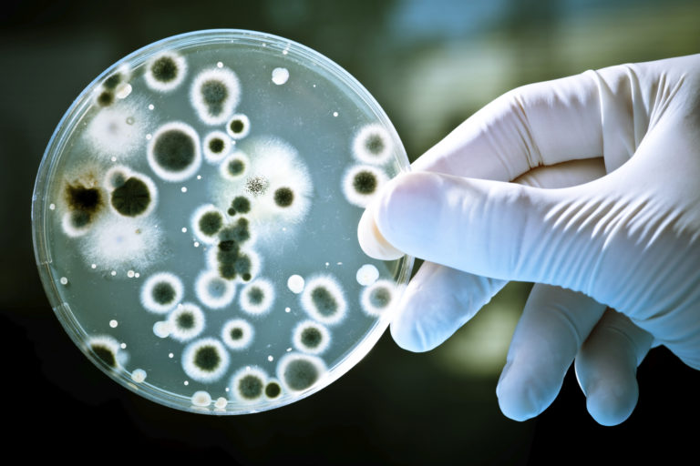 Parasites, Pathogenic Bacteria, MCAS and Mold