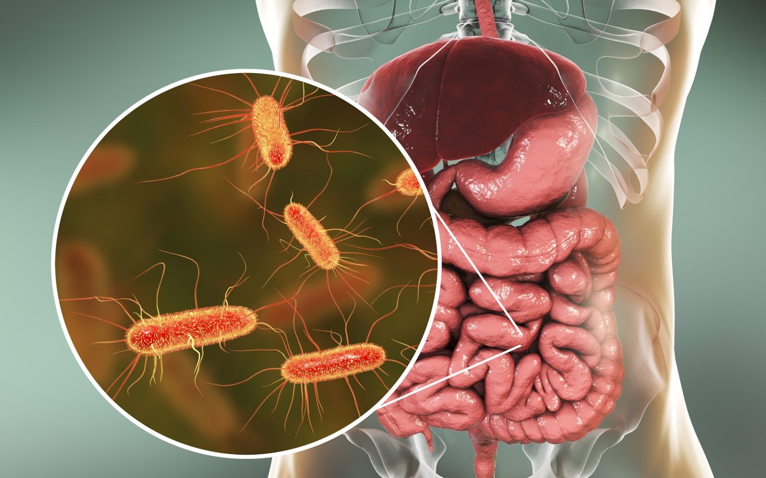 The Truth About the Symptoms of Hashimoto's Flare-Ups