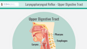 How to Identify and Treat Laryngopharyngeal Reflux (LPR)