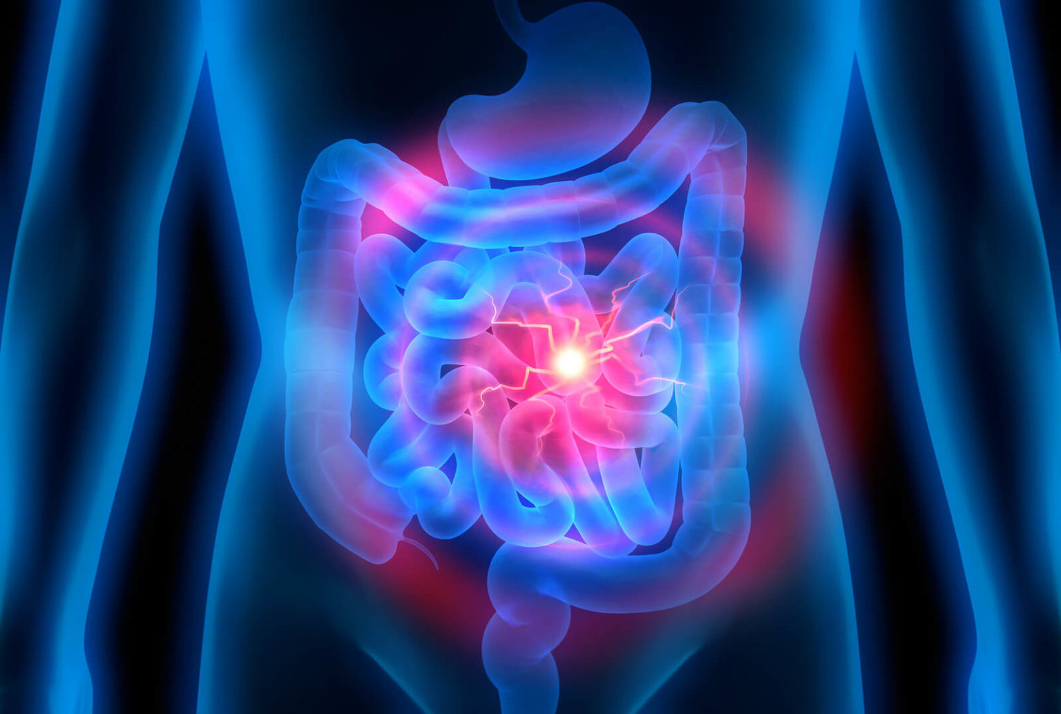 Can Prokinetic Agents Help SIBO and Gut Symptoms?