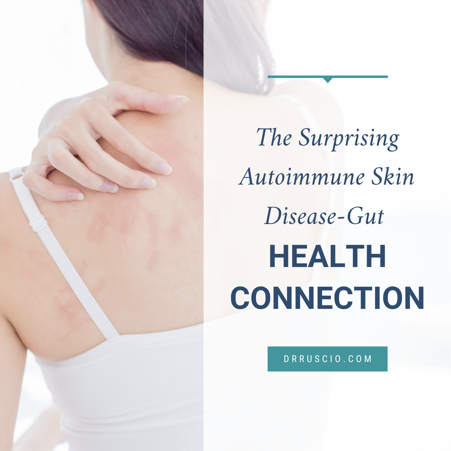 Chronically Low Vitamin D - The Infection Connection